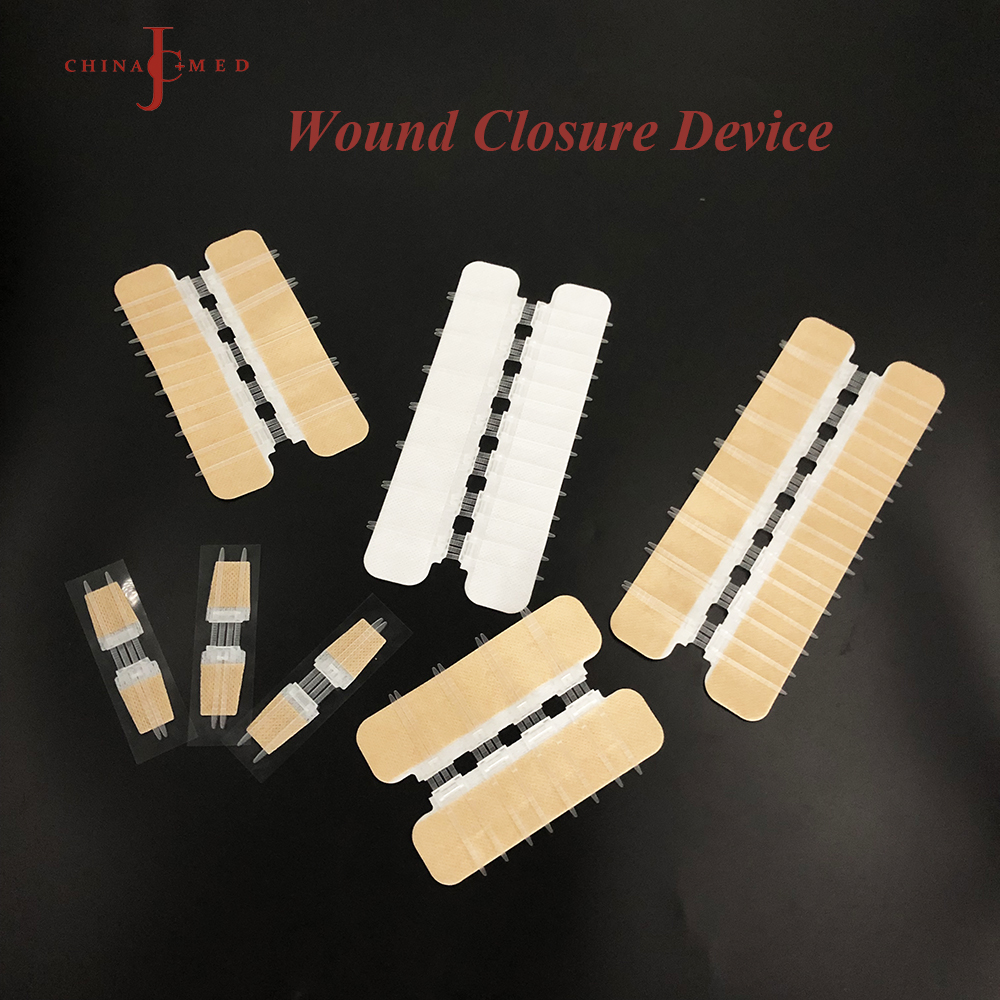 wound closure device zip stitches wound care with FDA