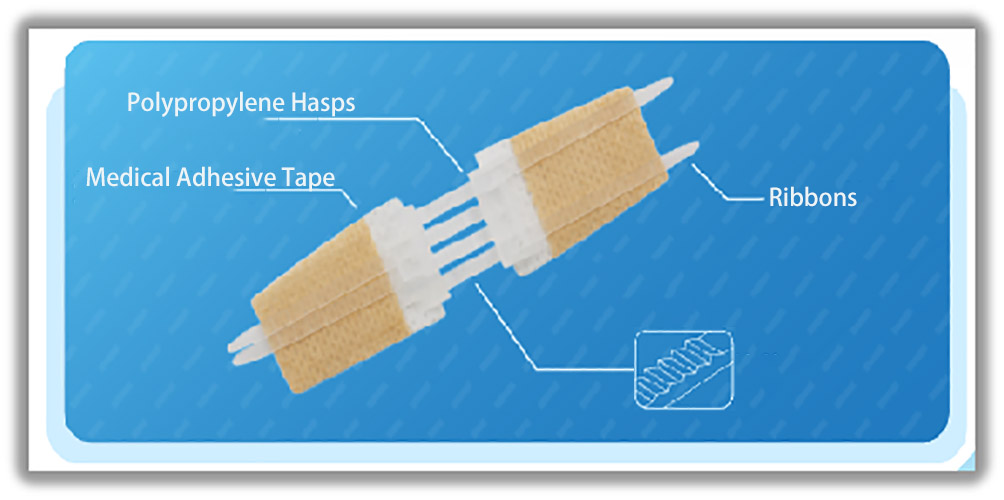wound closure device zip stitch wound care with FDA