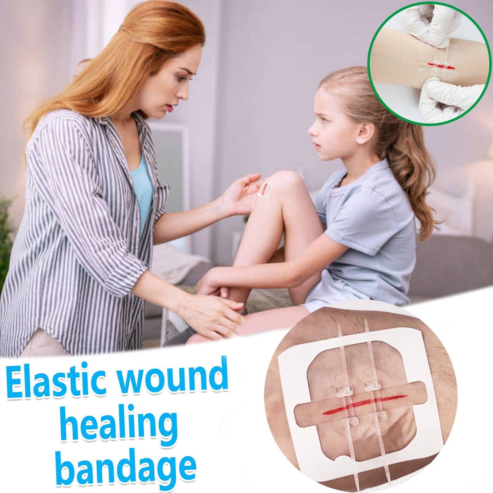 Wound closure without stitches relieves painful of wound suture