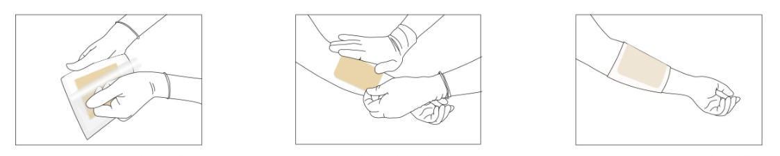 PU film foam dressing medical soft foam dressing without border surgical