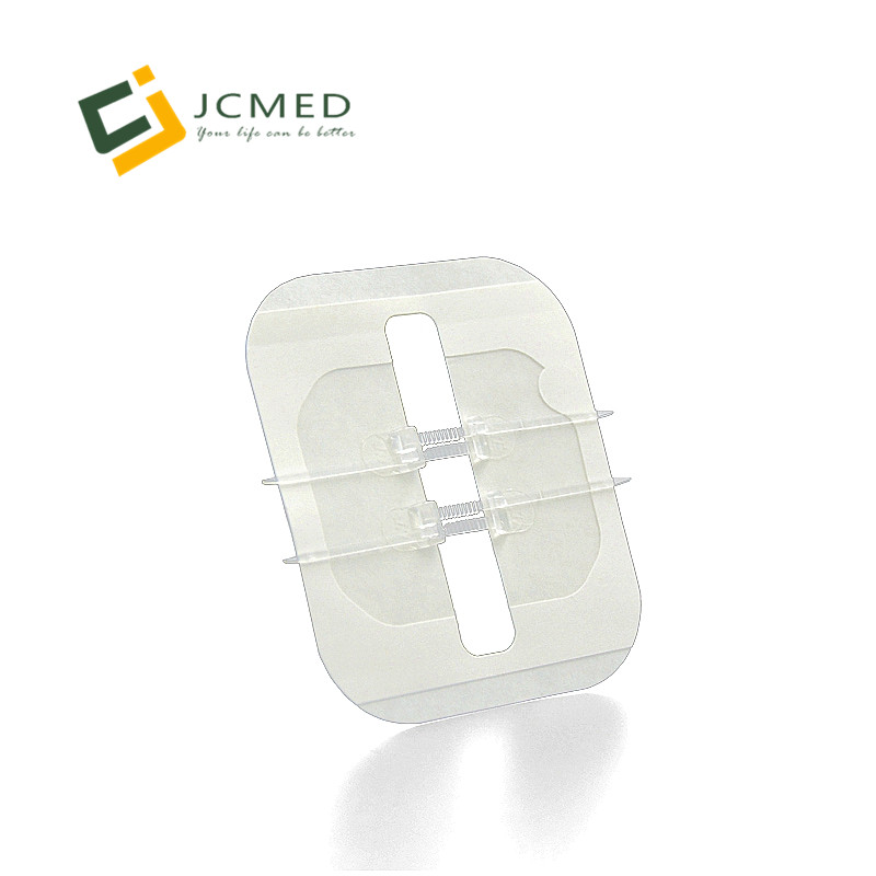 wound closure device zip stitches zip tie wound care with FDA