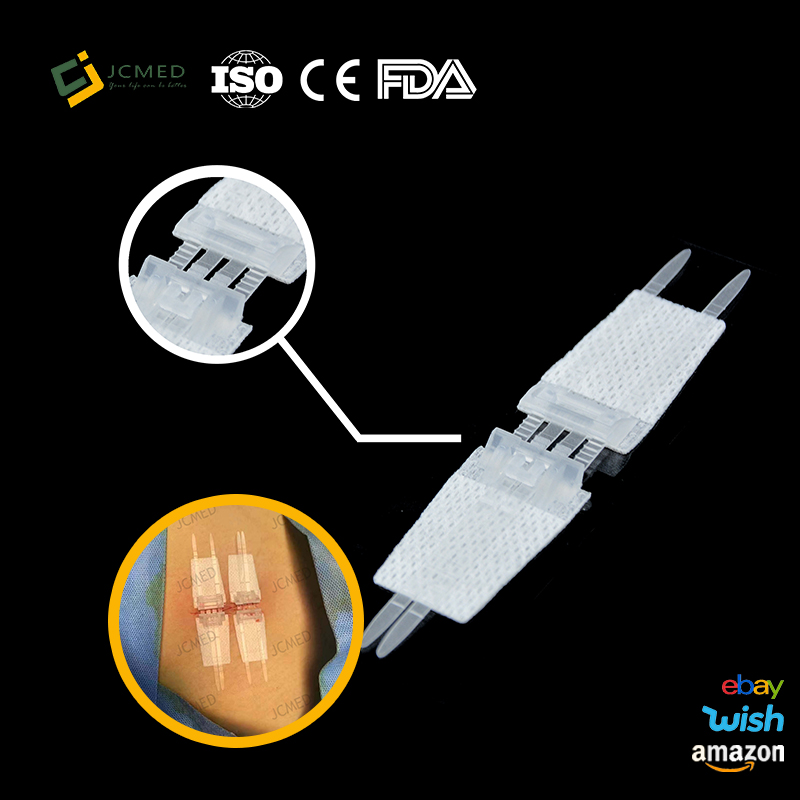 suture for skin closure zip stitch wound care with FDA