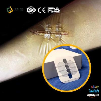 zipstitch wound closure zip tie wound care with FDA